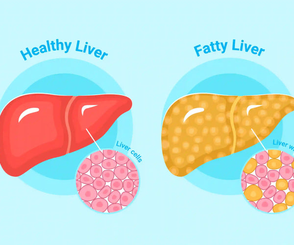 Understanding Liver Detox Supplements: Benefits, Ingredients, & Risk ...